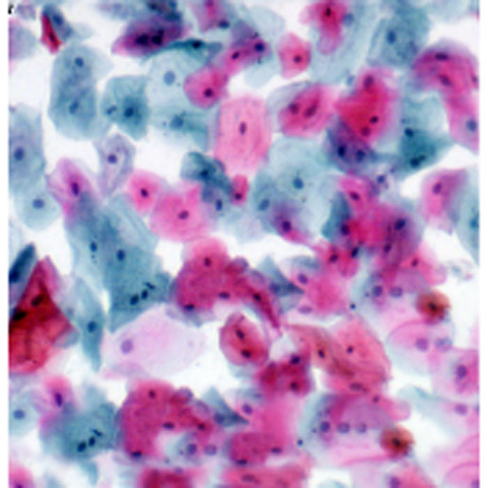 PAP Stain: Introduction, Principle, Staining Procedure,, 46% OFF